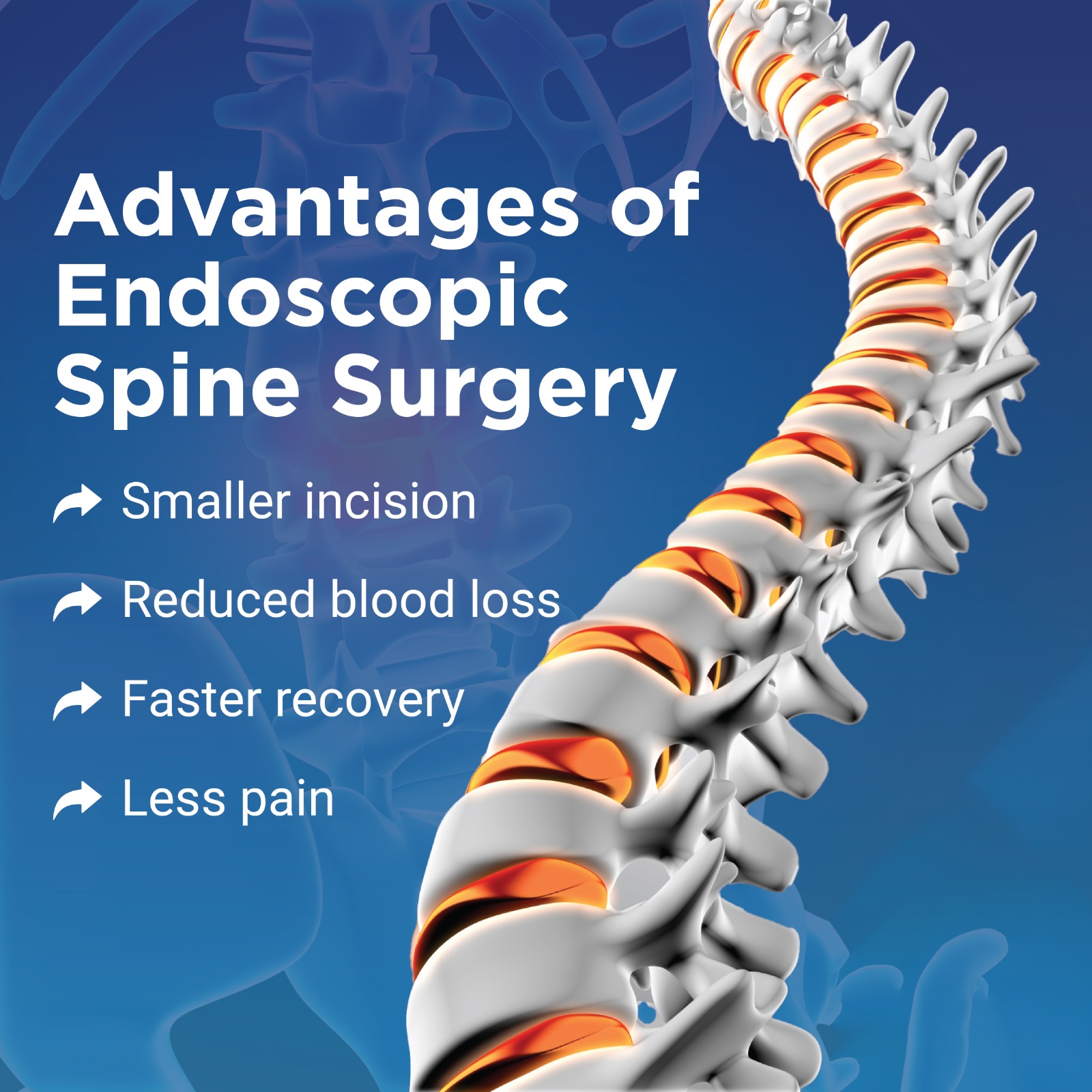 What is the Success Rate of Endoscopic Spine Surgery | IBS Hospital