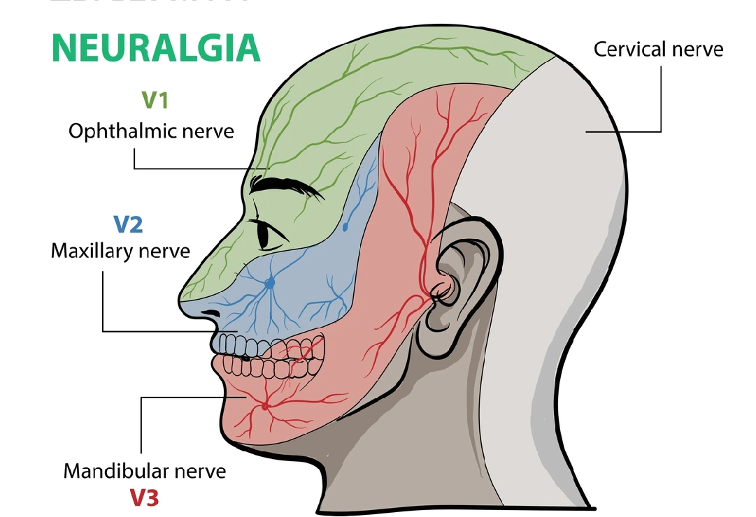 Neuralgias: Essential Information You Should Know | IBS