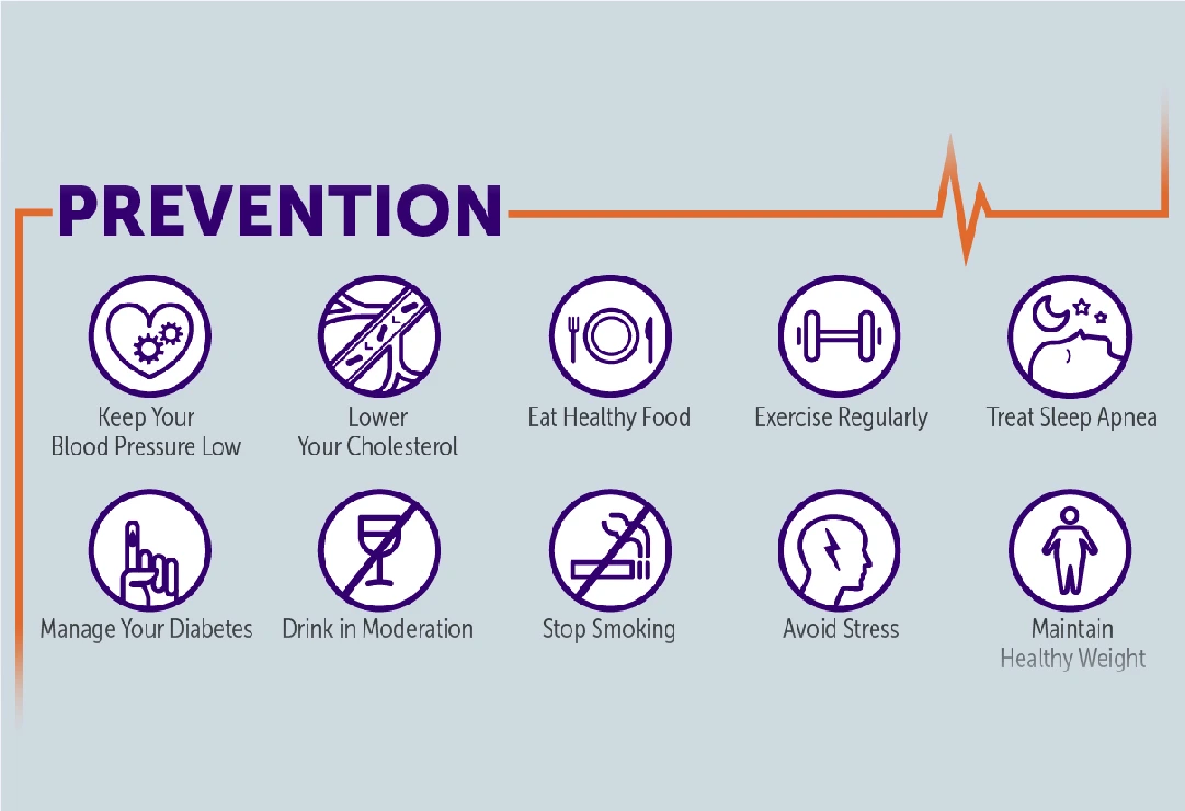 How to Prevent Stroke: The Ultimate Guide | IBS Hospital
