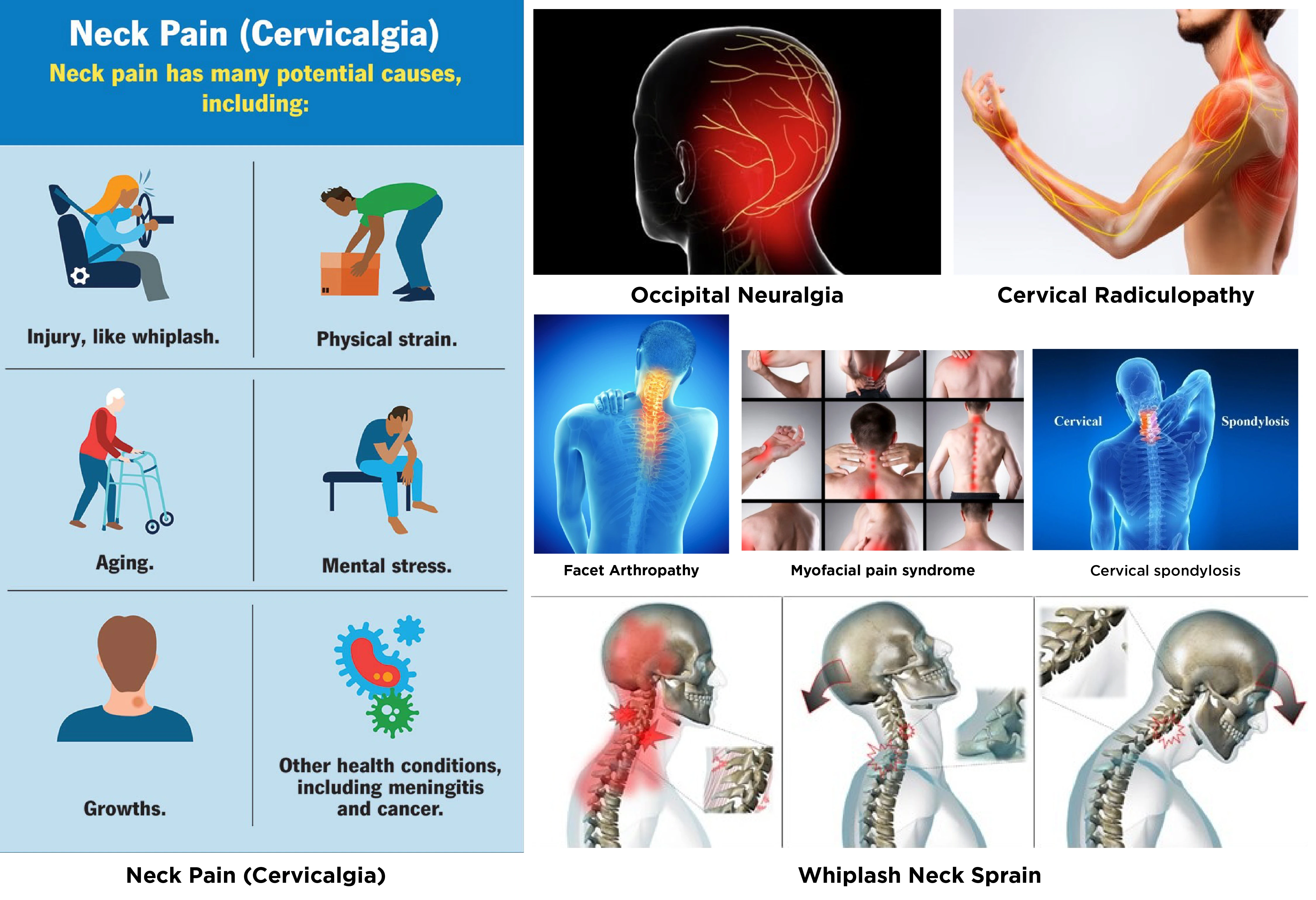 Neck Pain Treatments in Delhi: Causes, Symptoms, and Types | IBS Hospital