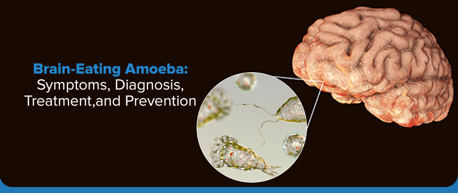 Brain-Eating Amoeba: Symptoms, Diagnosis, Treatment, and Prevention ...