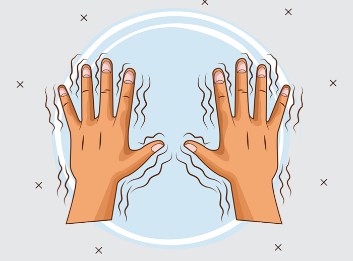 Movement Disorder Specialists in Delhi - IBS Hospital