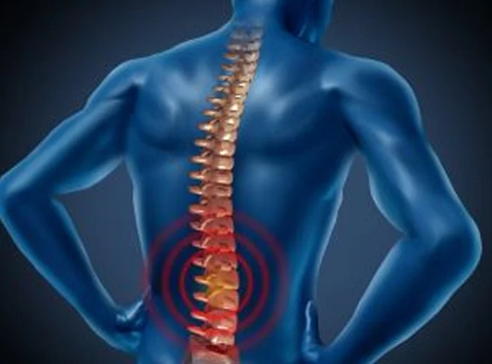 Microscopic Discectomy Recovery and Treatment in Delhi