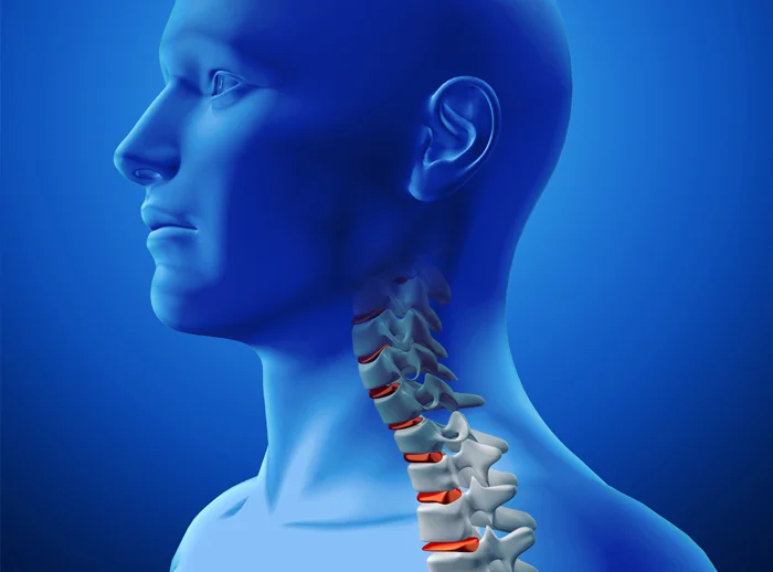 Cervical Disc Replacement and Surgery - (Spine Care)