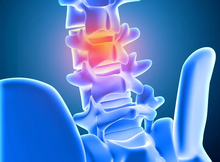 Vertebroplasty Kyphoplasty Treatment in Delhi - IBS Hospital