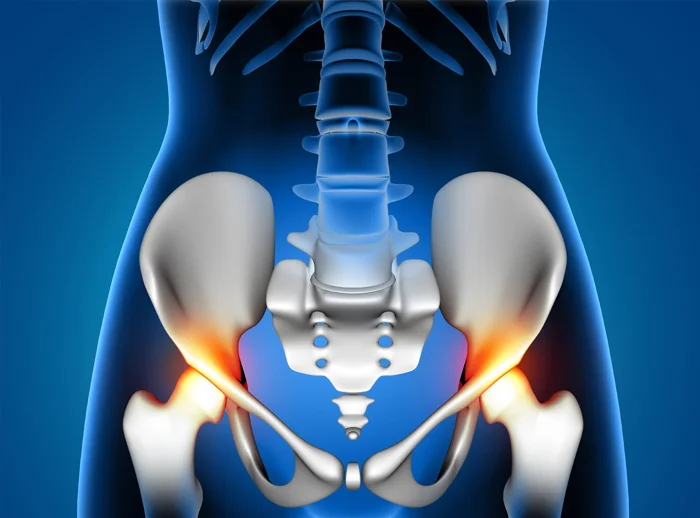 Best Pelvic and Acetabular Surgery in Delhi | IBS Hospital