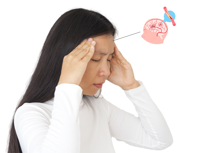 Transient Ischemic Attack - Symptoms and Causes