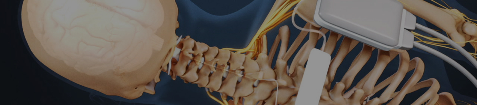 Best Neck Pain Solution With High Cervical Stimulation | IBS Hospital