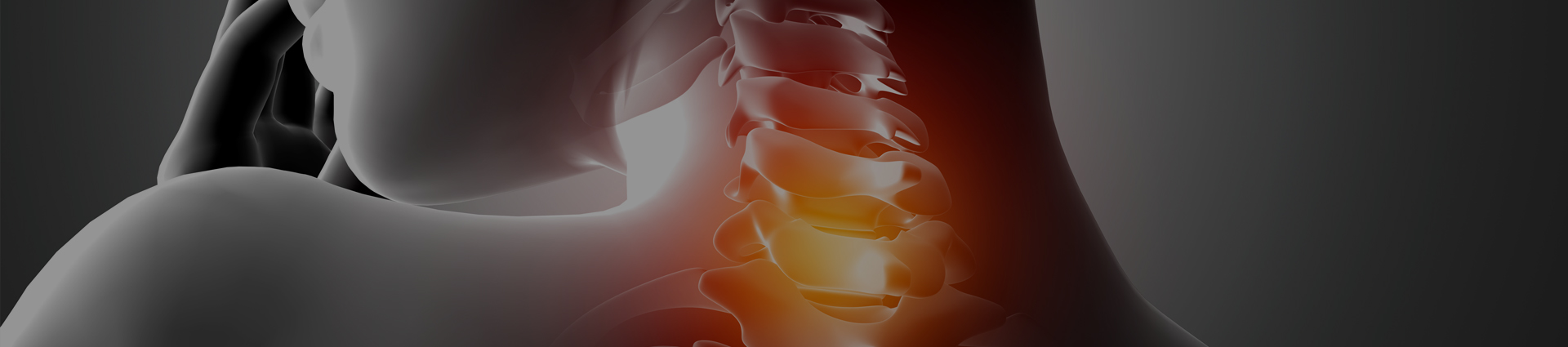 Posterior Cervical Fixation In Delhi - Spine Care