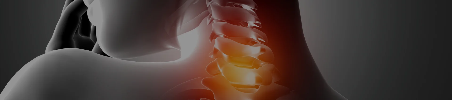 Posterior Cervical Fixation In Delhi - Spine Care