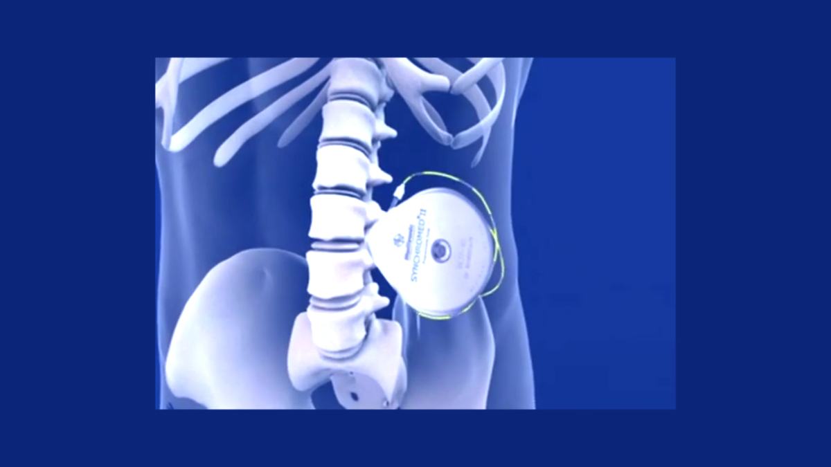 Pain Management and Spine care in Delhi - IBS Hospital