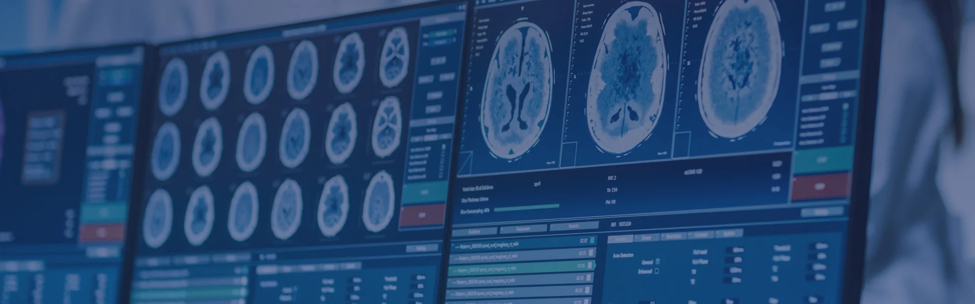 Intraoperative Nerve Monitoring | IBS Hospital