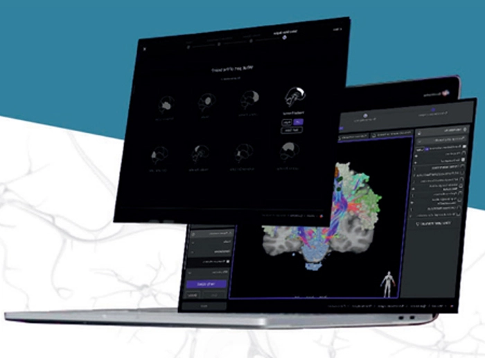 Personalized Brain Mapping | Advanced Treatments | IBS Hospital
